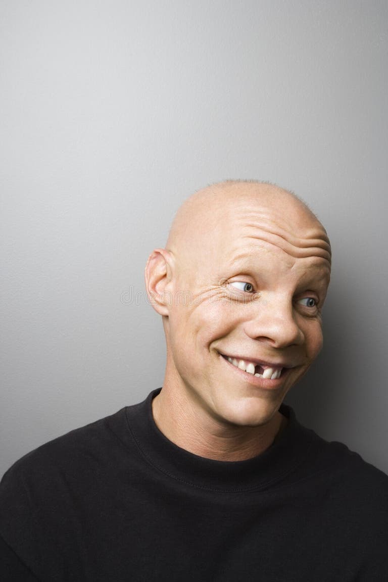 417 Man Missing Teeth Stock Photos - Free & Royalty-Free Stock Photos ...