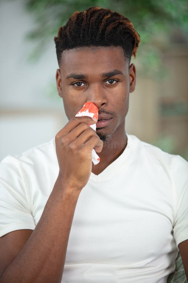 Man with Nose Bleed at Home Stock Photo - Image of nosebleed, illness ...