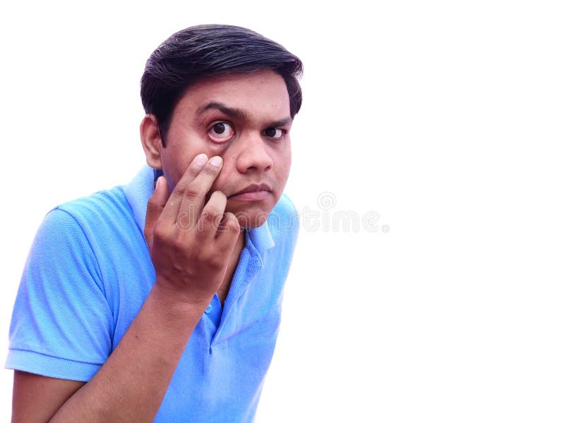 Man Open Eyes by Hand Looking into Camera Stock Image - Image of ...