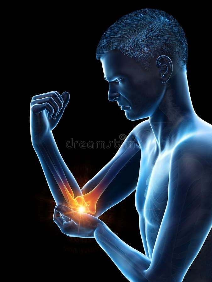 A man with painful elbow stock illustration. Illustration of joint ...