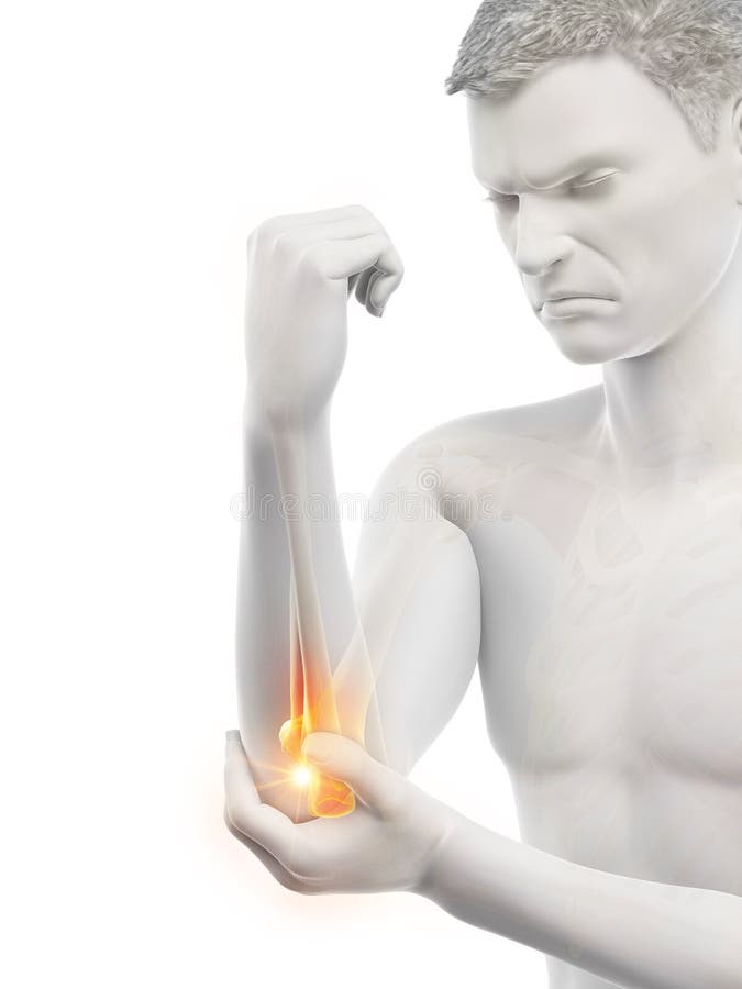 A man with painful elbow stock illustration. Illustration of arthritis ...