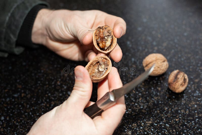 A Man Peeled a Walnut that Was Spoiled. Infestation of the Fruit by the ...