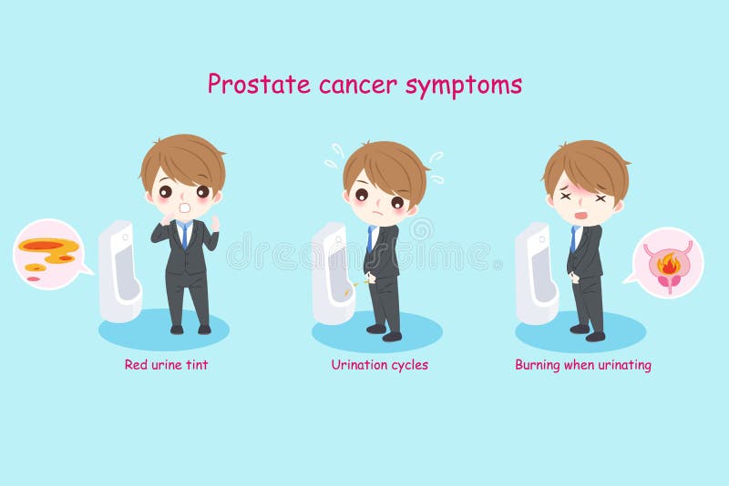 Prostate Stock Illustrations – 7,143 Prostate Stock Illustrations ...