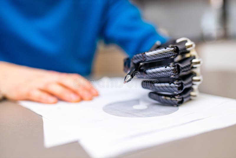 Man with Prosthetic Hand Writing Development at Home Stock Photo ...
