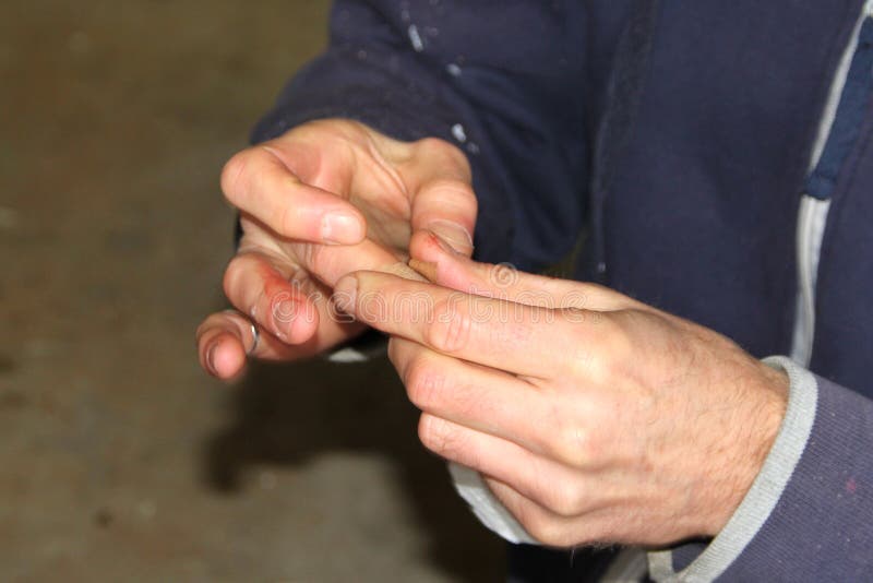 Man Putting Band-aid Around His Bleeding Finger Stock Photo - Image of ...