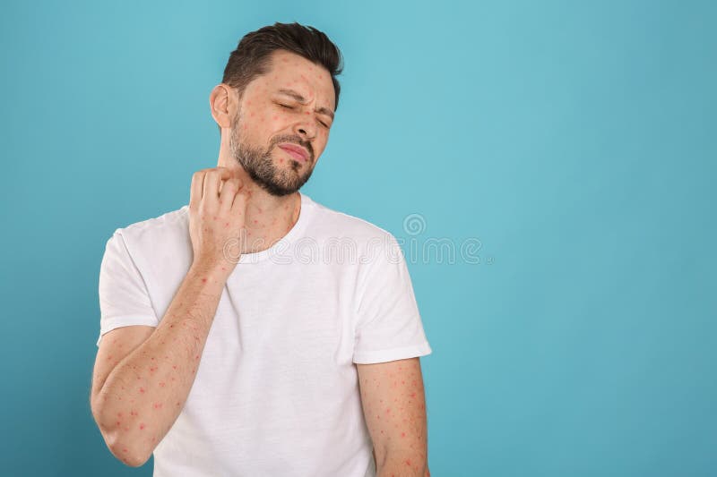 Man Suffering from Eyestrain on White Background Stock Photo - Image of ...