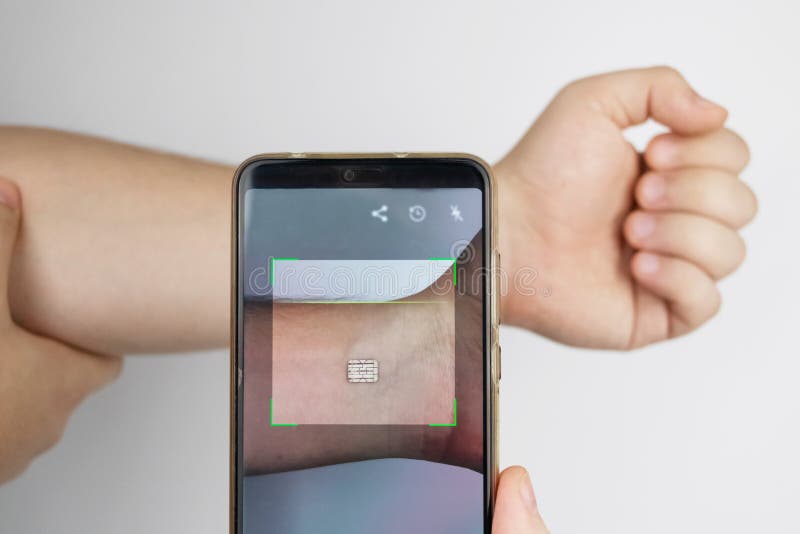 A Man Reads Data Using a Special Device from an Implanted Chip in a Man ...