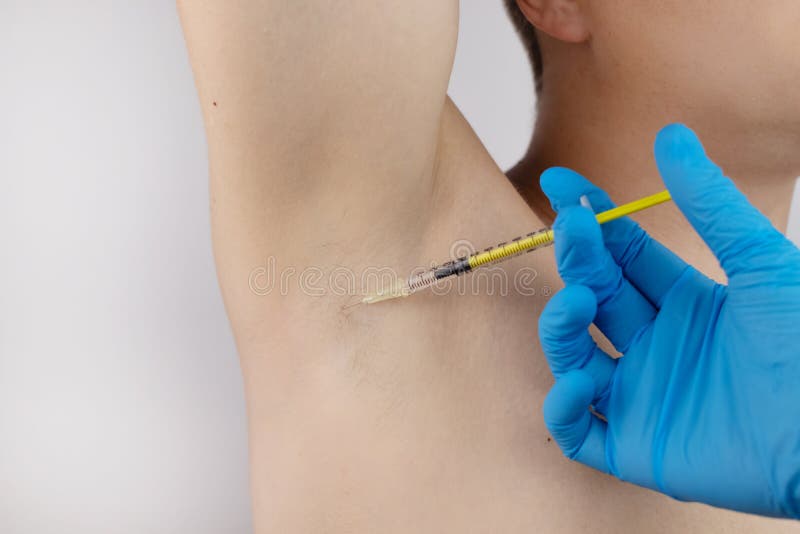 Man Receiving Botox Injection in Armpit As Treatment of Hyperhidrosis ...