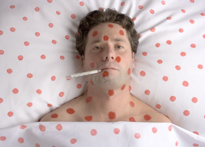 Man with Red Spots on Face and Body Stock Photo - Image of suffering ...