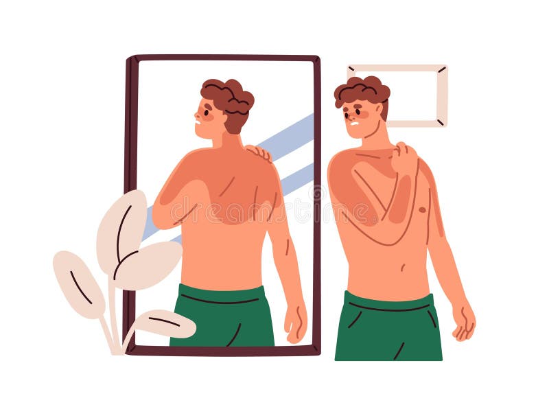 Man Sunburn Skin Stock Illustrations 226 Man Sunburn Skin Stock