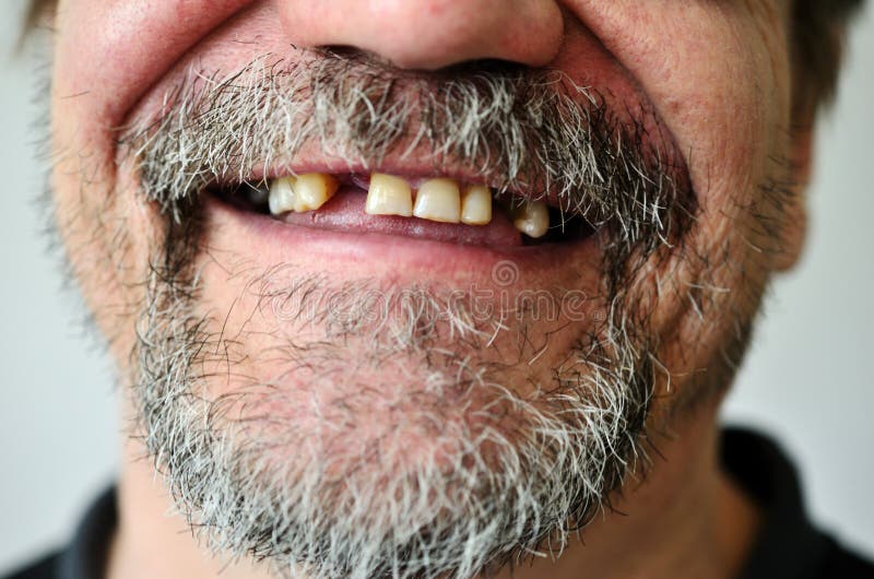 798 Toothless Man Stock Photos - Free & Royalty-Free Stock Photos from ...