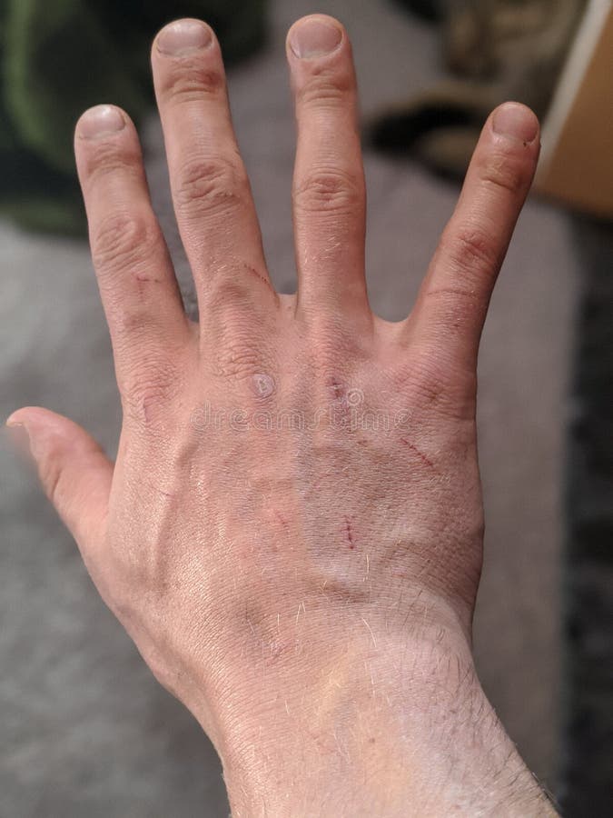 A Man S Hand with Scratches Stock Photo - Image of clean, lifestyles ...