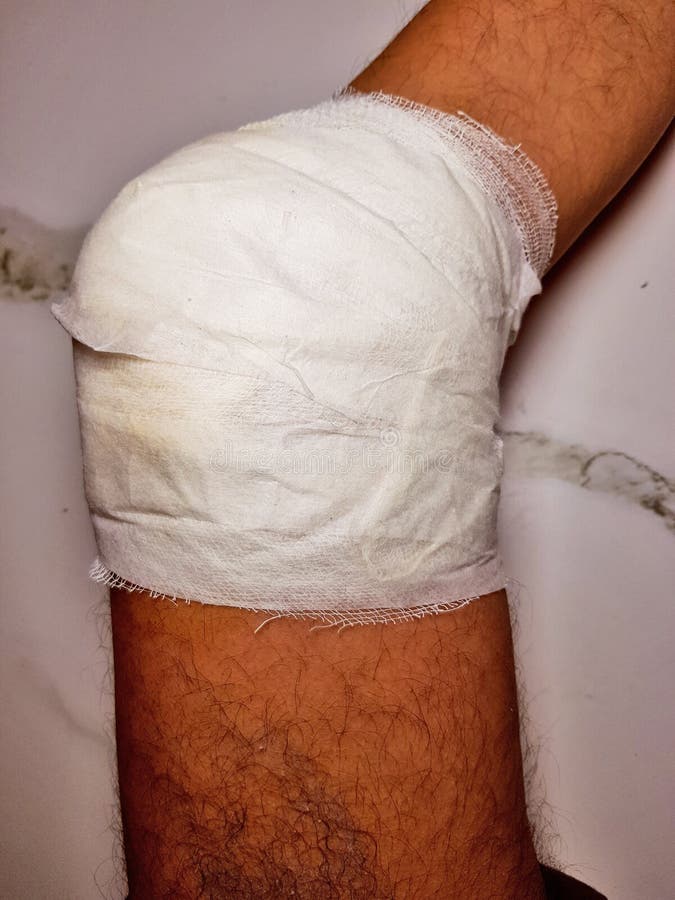 A man`s knee is bandaged stock image. Image of medicine - 169235875