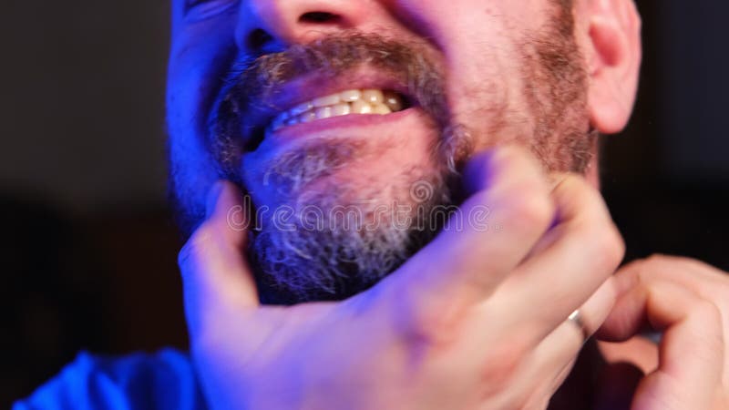 The Man is Scratching His Beard. Skin Irritation Concept Stock Video ...
