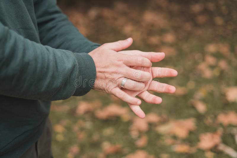 Man scratching his hand stock photo. Image of fingers - 262518714
