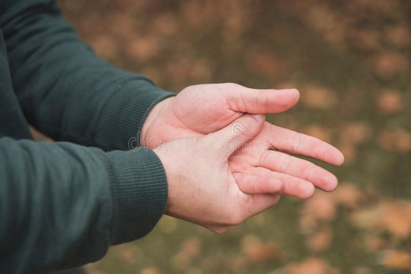 Man scratching his hand stock image. Image of fingers - 262518729