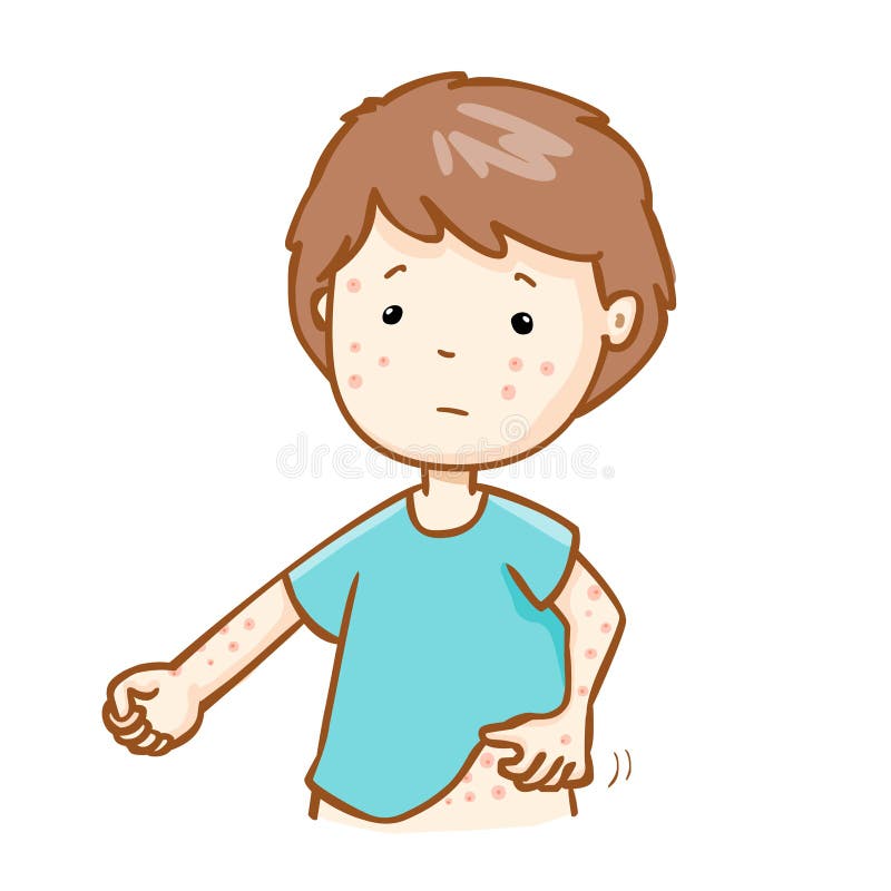 Man Scratching Itching Rash on His Body Stock Vector - Illustration of ...