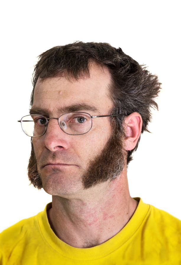 Walleyed man stock image. Image of scary, exotropia, looking - 17581275