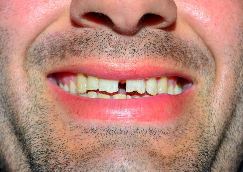 Man smiling stock image. Image of health, people, front - 48554543