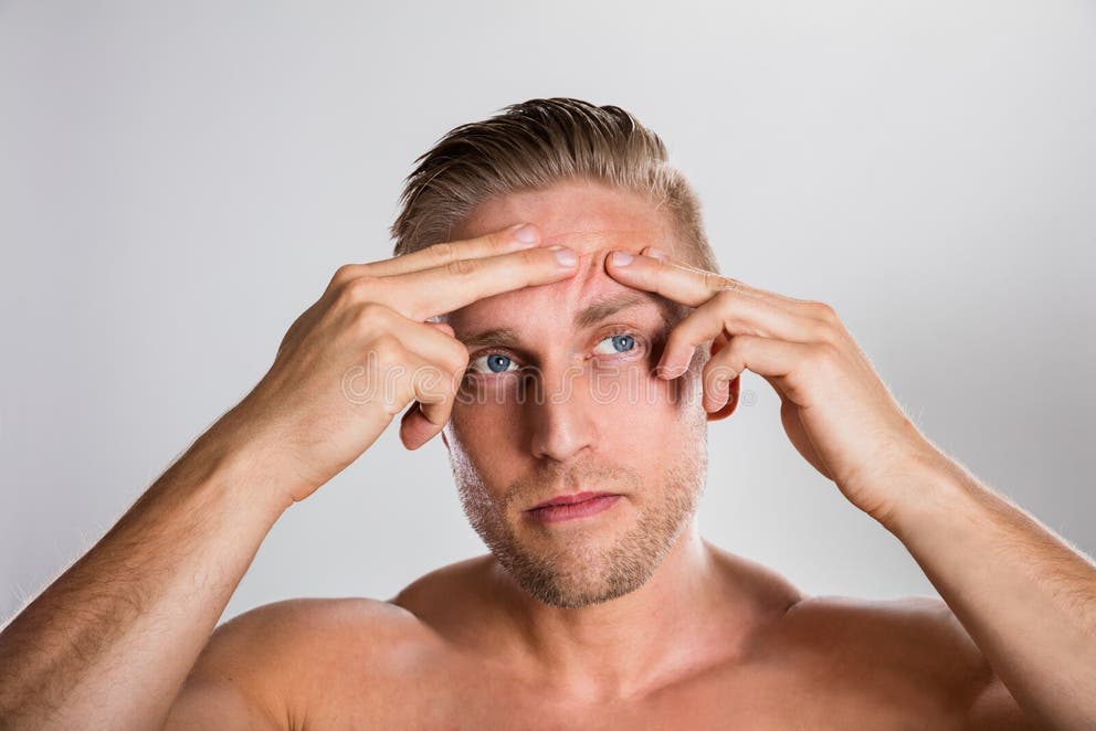 Man Squeezing Pimple on His Forehead Stock Image - Image of pimples ...