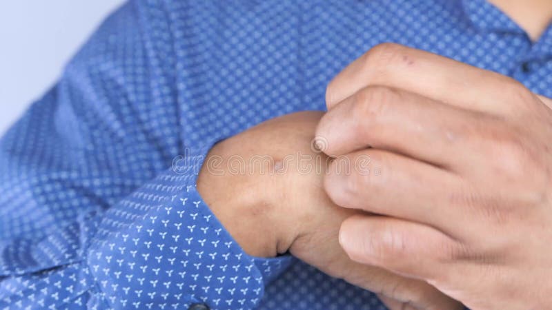 Man Suffering from Itching Skin, Close Up. Stock Video - Video of ...