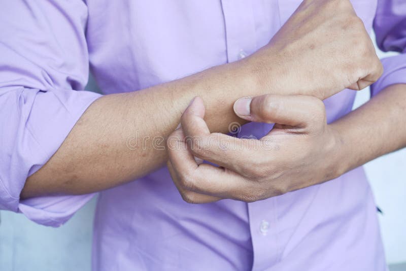 Man Suffering from Itching Skin, Close Up. Stock Photo - Image of male ...