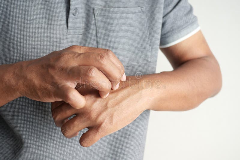 Man Suffering from Itching Skin, Close Up. Stock Image - Image of itch ...