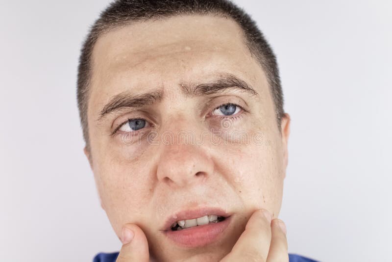 A Man with Sweating on His Face is Looking at the Camera. Sweat Gland ...