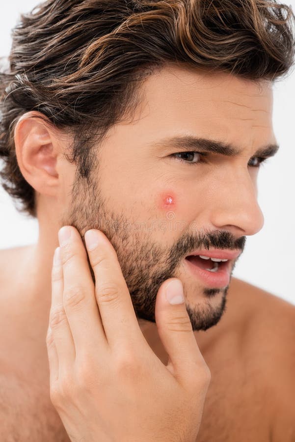 Man Touching Cheek with Acne Isolated Stock Photo - Image of gray ...
