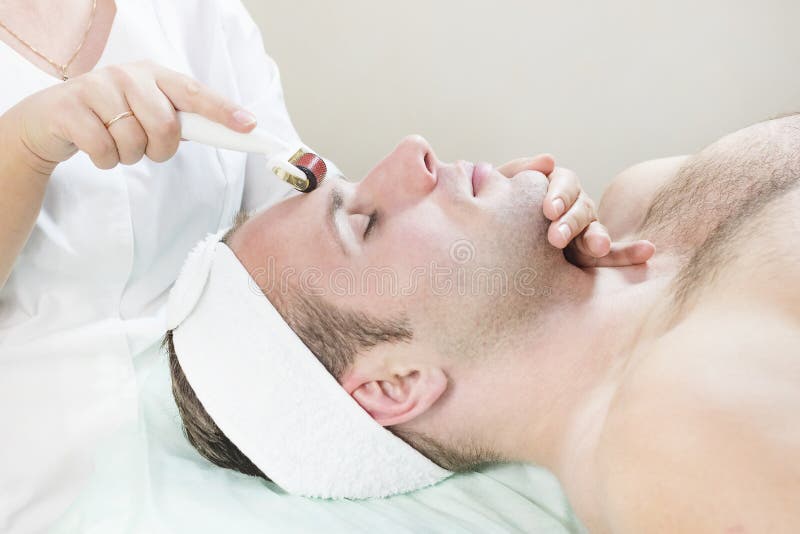 Man Undergoes the Procedure of Medical Micro Needle Therapy with a ...