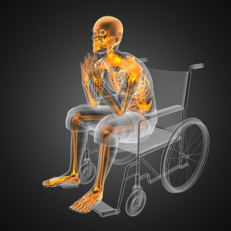 Skeleton Wheelchair Stock Illustrations – 355 Skeleton Wheelchair Stock ...