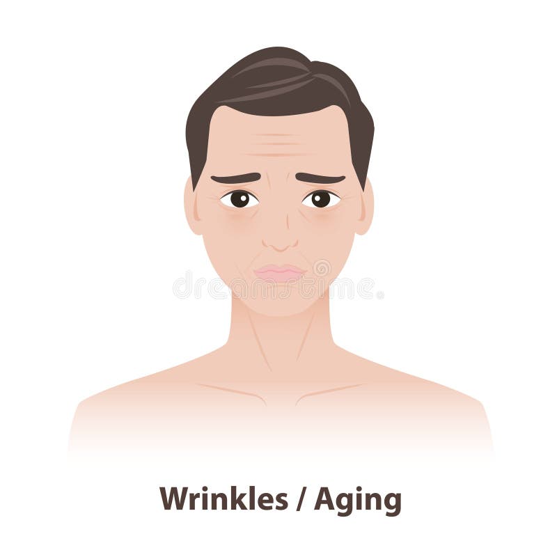Botox Fillers Cartoon Stock Illustrations – 10 Botox Fillers Cartoon ...