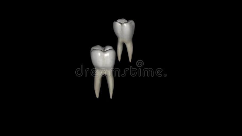 The Mandibular First Molar Usually Has Two Roots, a Mesial and a Distal ...