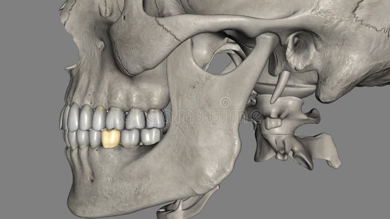 The Mandibular First Molar Usually Has Two Roots, a Mesial and a Distal ...