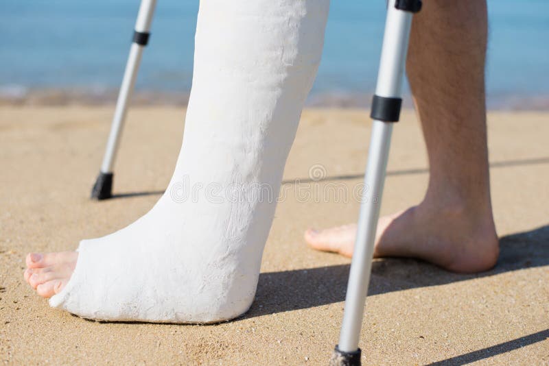 Mann Mit Gips Gehend Auf Den Strand Stockbild - Bild von paris ...