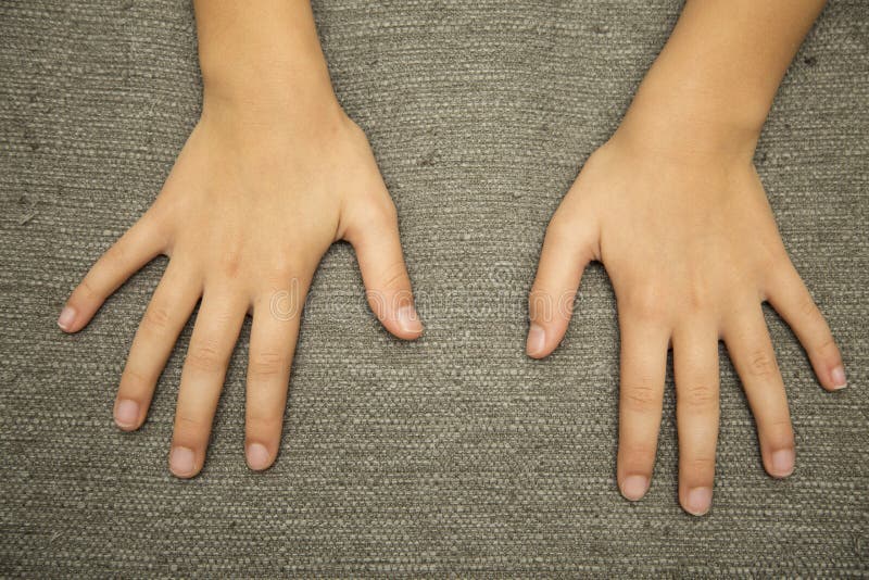 Mano foto de archivo. Imagen de dedos, gesto, cuidado - 101993910