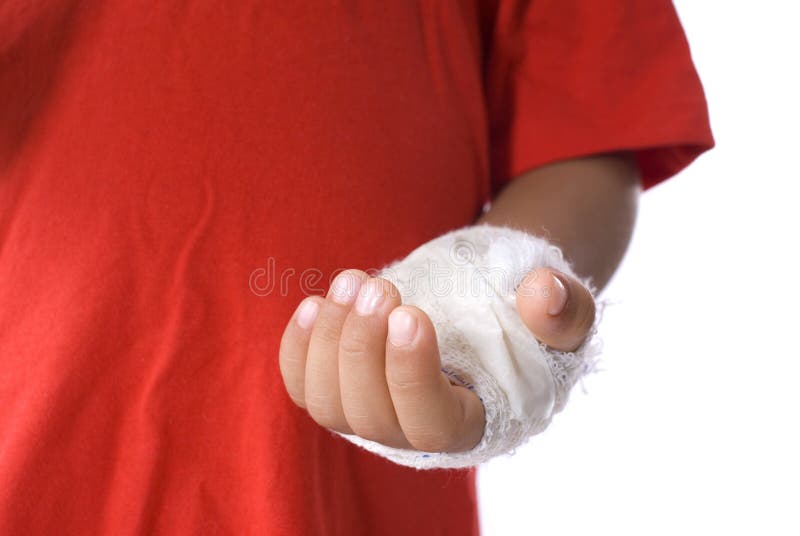 Mano lastimada imagen de archivo. Imagen de mano, brazos - 8047939