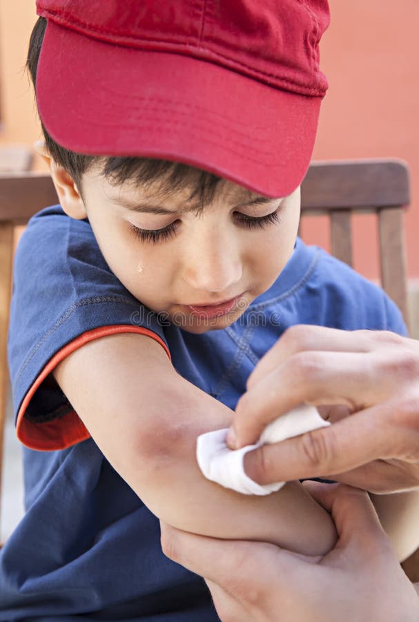 Codo Raspado #3 - 9 Días Después Del Accidente. Foto de archivo ...