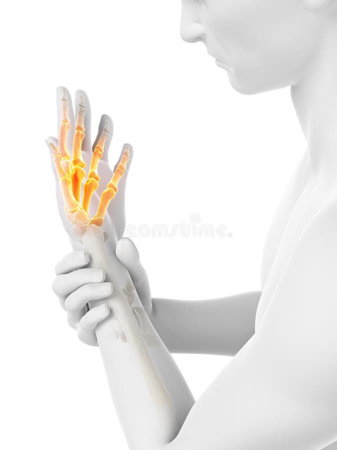 Painful Fingers Stock Illustrations – 628 Painful Fingers Stock ...
