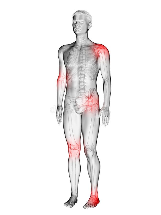 A mans painful joints stock illustration. Illustration of human - 145649543
