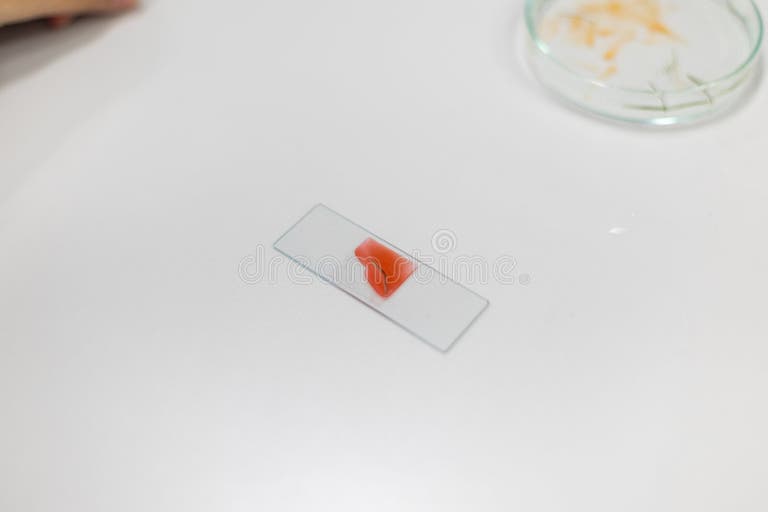 Manual Dissection of Plant Tissue Samples for Study. Stock Image ...