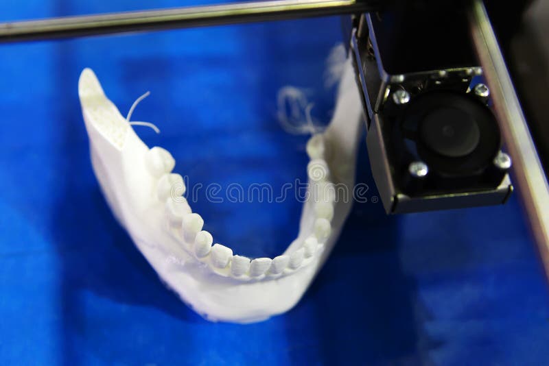 Making Teeth on a 3D Printer. the Human Jaw Model is Made of Plastic ...