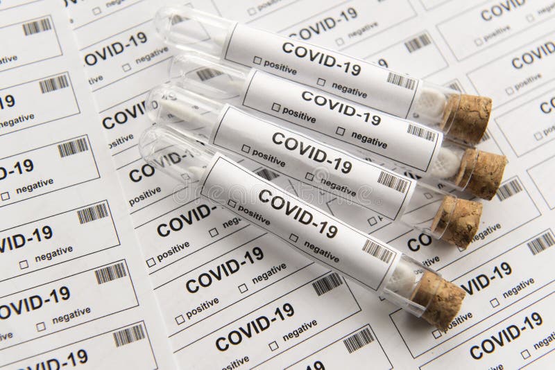 Many Covid-19 Lots of Testing Stock Photo - Image of chinese, 2019ncov ...