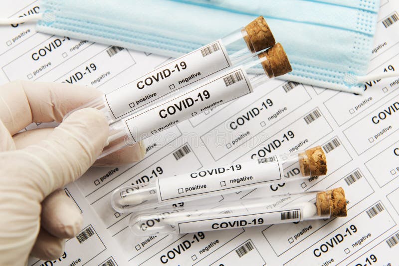 Many Covid-19 Lots of Testing Stock Photo - Image of testtube, research ...