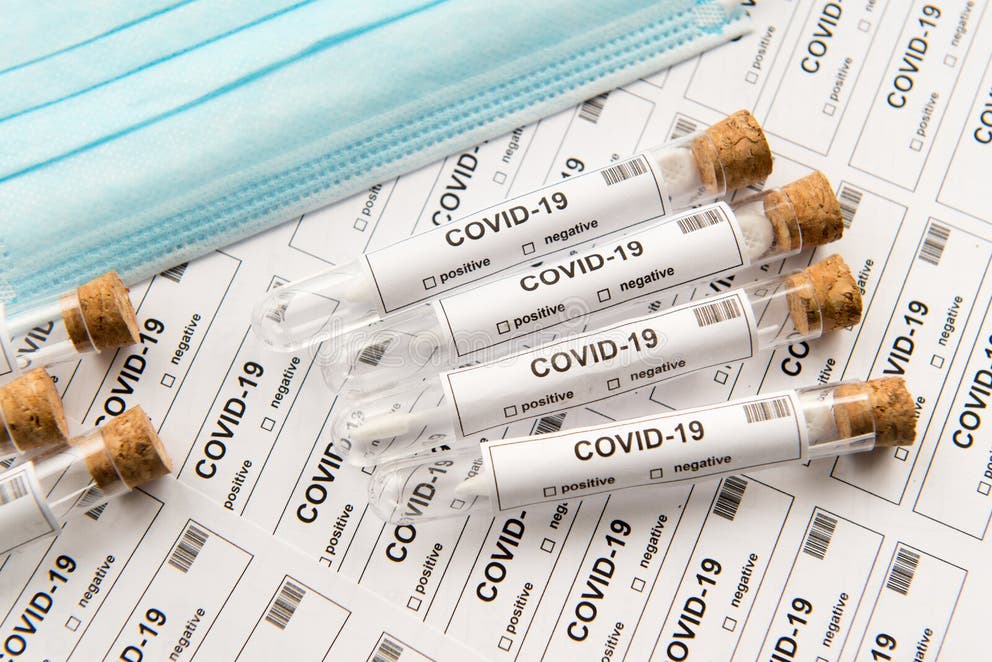 Many Covid-19 Lots of Testing Stock Image - Image of illness, science ...