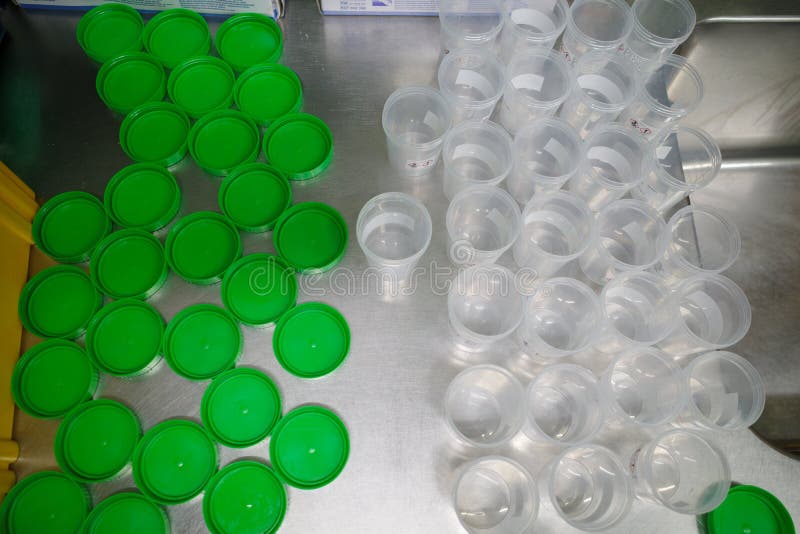 Many Preparation Pots Were Opened To Fill Them with Formalin Stock ...