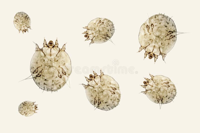 Scabies Human Stock Illustrations – 176 Scabies Human Stock ...