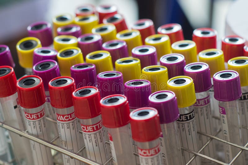 Many test tubes stock image. Image of sample, medicine - 40157875