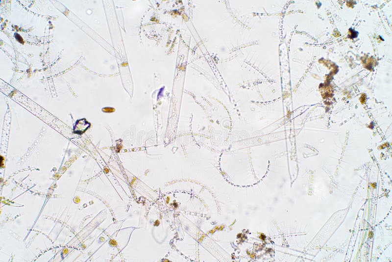 Marine Aquatic Plankton Under Microscope View Stock Photo - Image of ...