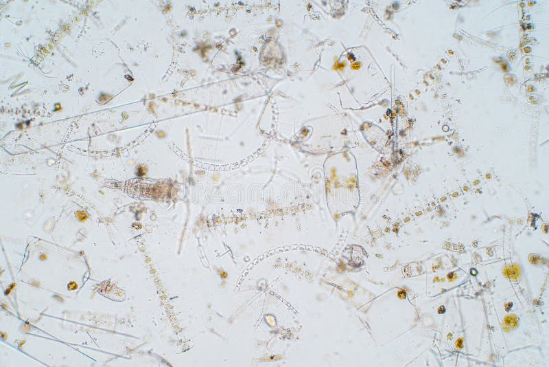 Marine Aquatic Plankton Under Microscope View Stock Photo - Image of ...